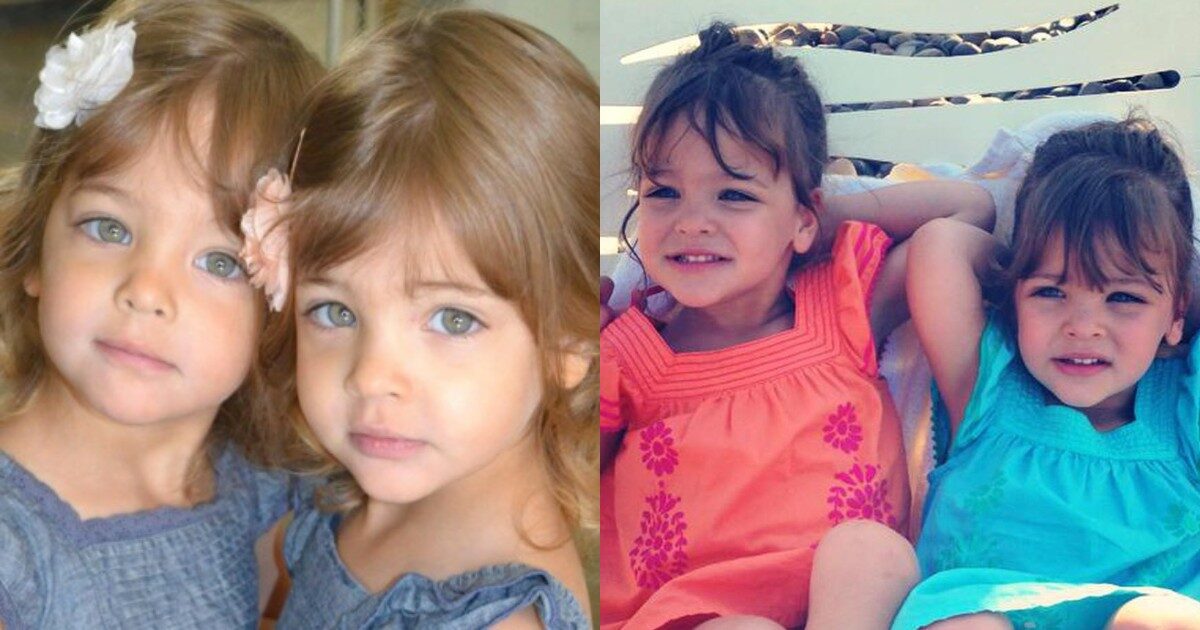 To 2010 είπαν πως ήταν οι πιο όμορφες δίδυμες του κόσμου, σήμερα είναι ...