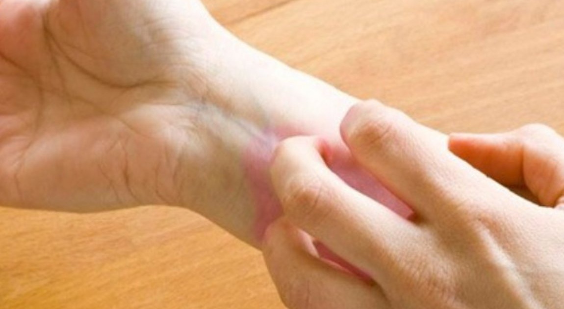 Τα σπυράκια στα χέρια που «δείχνουν» ότι… πρέπει να πάτε σε καρδιολόγο ...