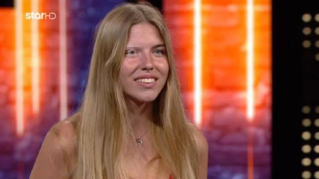 GNTM 5: «Ξύπνησα και το μισό μου πρόσωπο ήταν λευκό» – H 18χρονη με τη λεύκη που ξετρέλανε τους ...