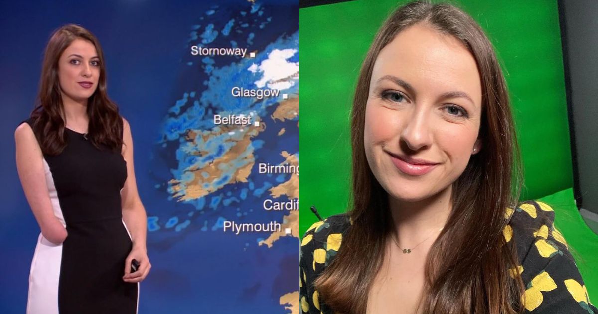 Μόνο θαυμασμός: H Lucy Martin είναι ο πρώτος άνθρωπος με εμφανή ...